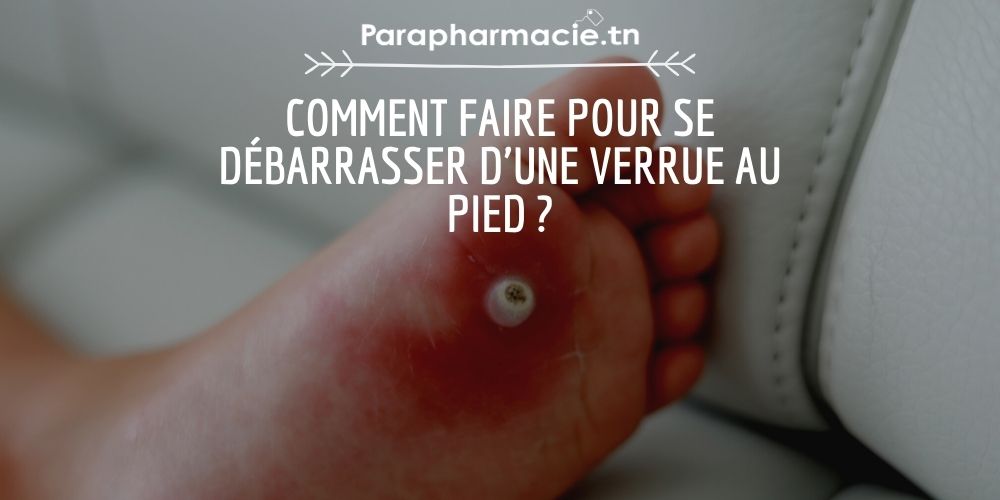 Comment faire pour se débarrasser d'une verrue au pied ? | Parapharmacie.tn