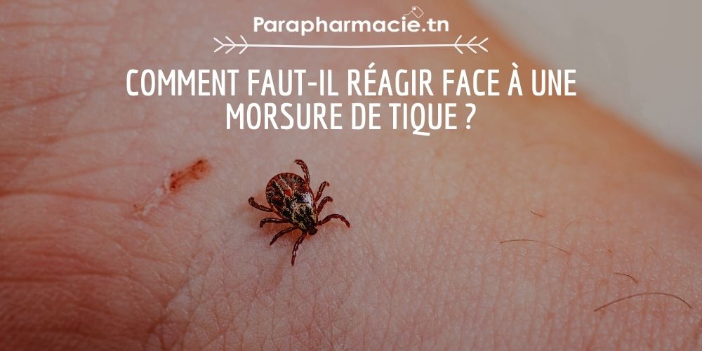 Comment faut-il réagir face à une morsure de tique ? | Parapharmacie.tn
