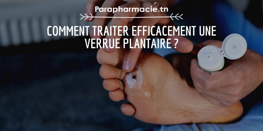 Comment traiter efficacement une verrue plantaire ? | Parapharmacie.tn