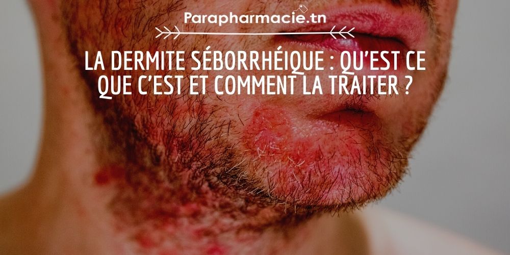 La dermite séborrhéique : qu'est ce que c'est et comment la traiter ...