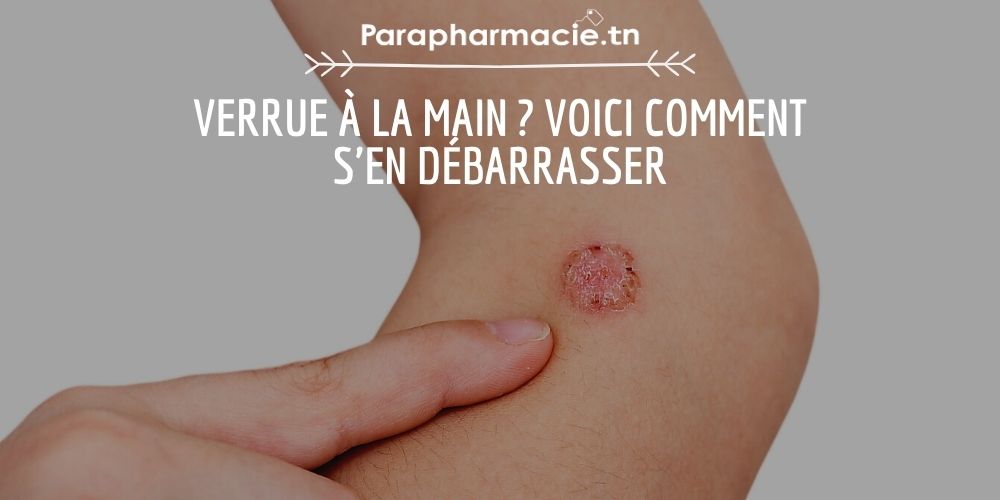 Verrue à la main ? Voici comment s'en débarrasser | Parapharmacie.tn